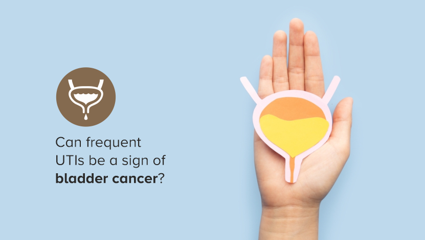 Frequent UTIs: Sign of Bladder Cancer | American Oncology Institute