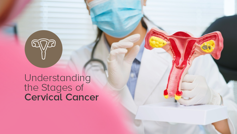 Understanding the Stages of Cervical Cancer